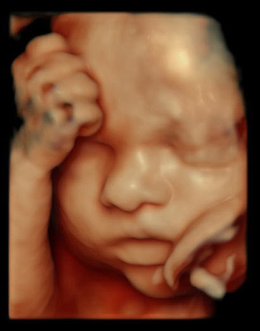 Ultrasona Fetal Fotos - Unparalleled HD Live & 3D/4D Ultrasound Imaging ...